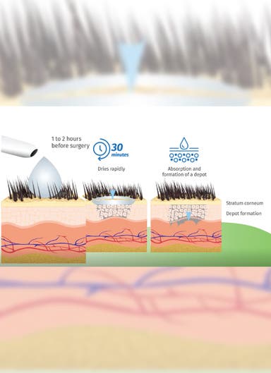 Zorbium® (Buprenorphine Transdermal Solution) for Cats