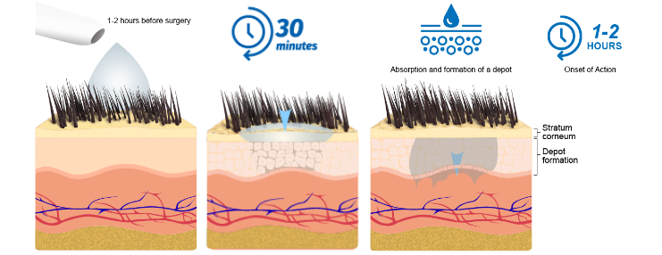 Zorbium® (Buprenorphine Transdermal Solution) for Cats