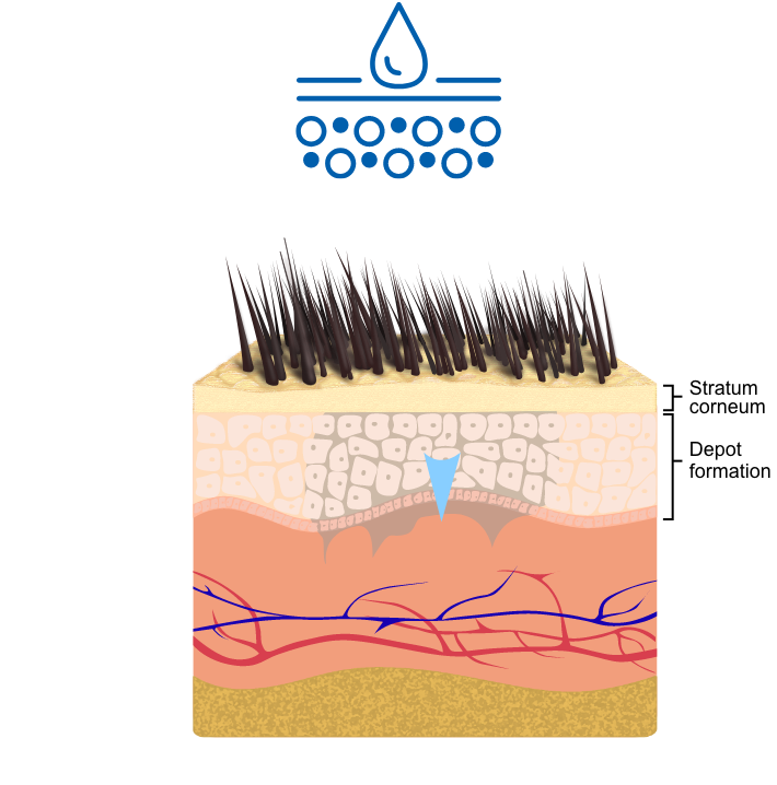 Zorbium™ (buprenorphine transdermal solution)