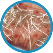 6 Parasites That Can Threaten Your Dog’s Health